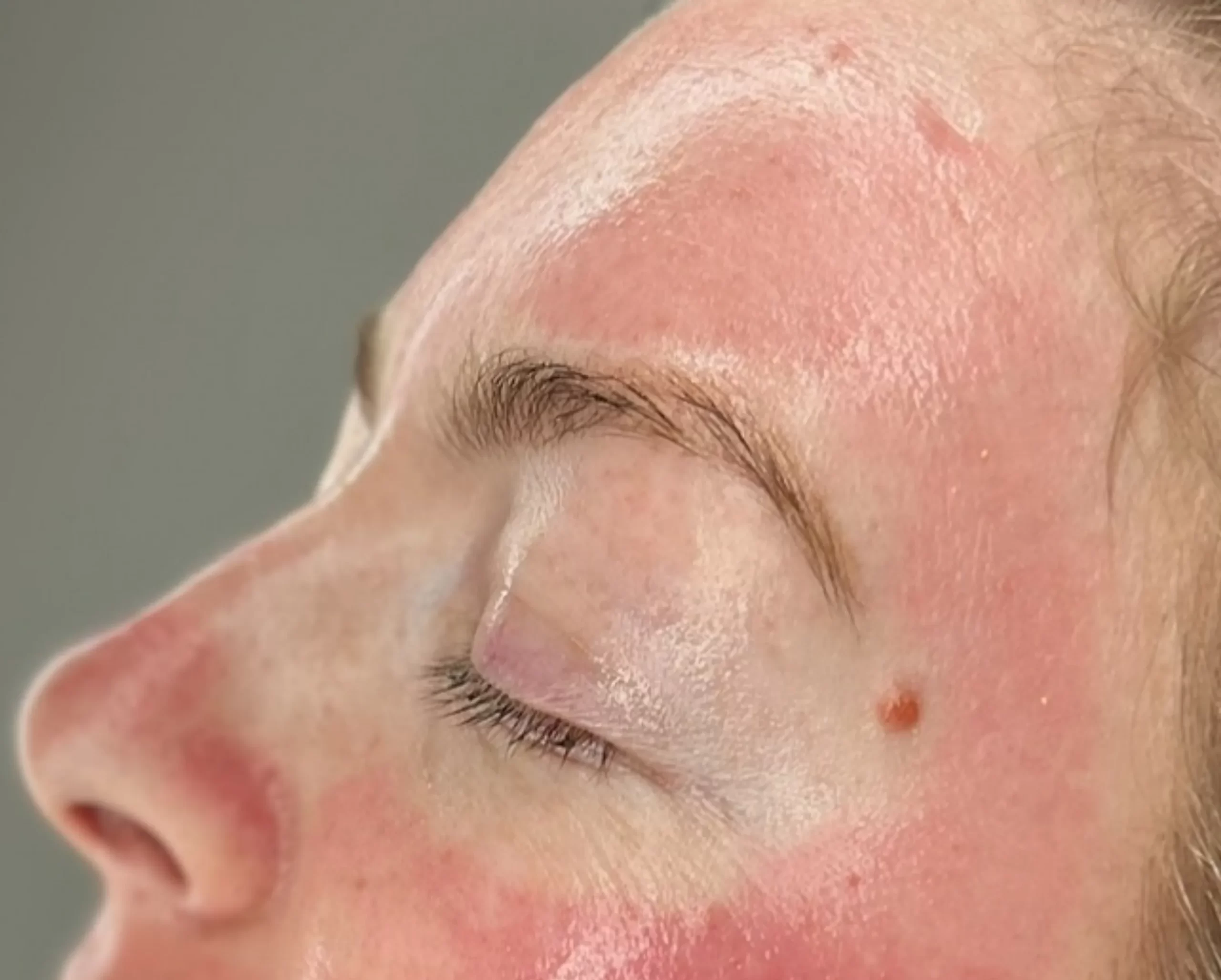 What’s the Best Type of Facial to Get?